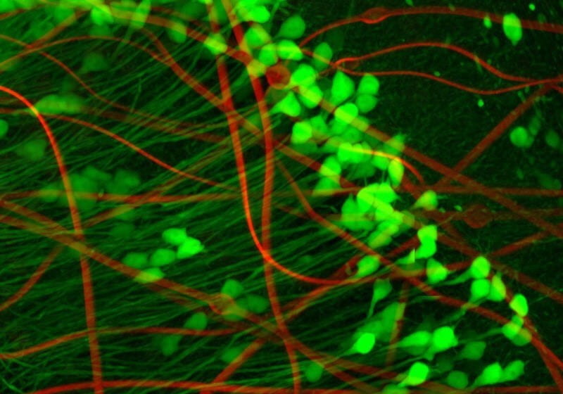 Brain Science and Neural Interface – Lieber Lab